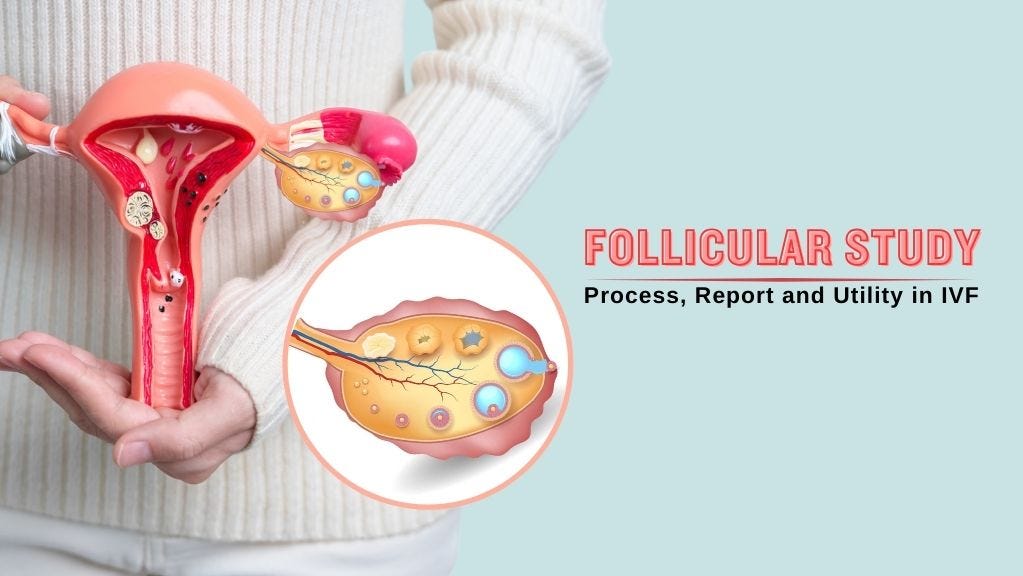 Follicular Study Process Report And Utility In IVF By Gaudium IVF follicular-study-process-report-and-utility-in-ivf-by-gaudium-ivf