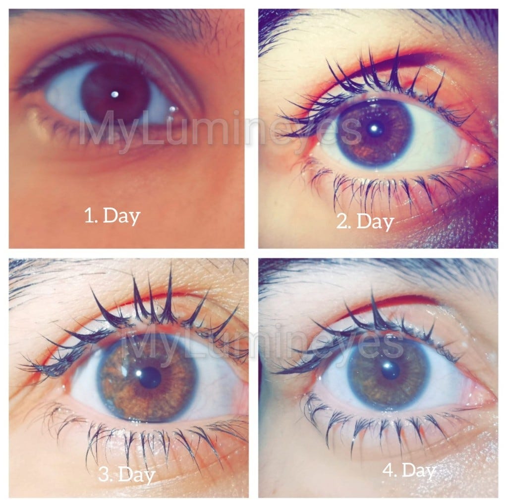 What are the long-term risks of eye color changing surgery? | by ...
