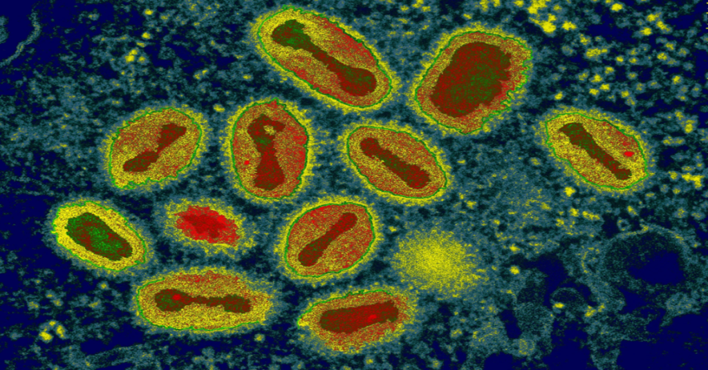 Smallpox: A Historical Overview of the Eradicated Disease…Check This ...