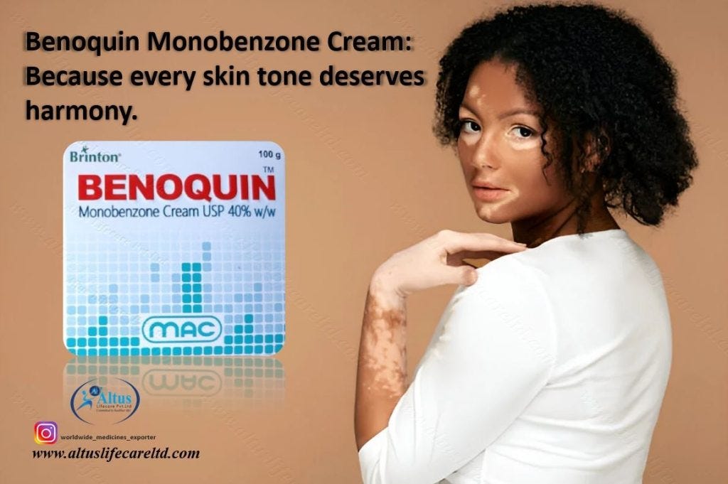 Benoquin Cream’s Remarkable Journey in Vitiligo Therapy | by Altus ...