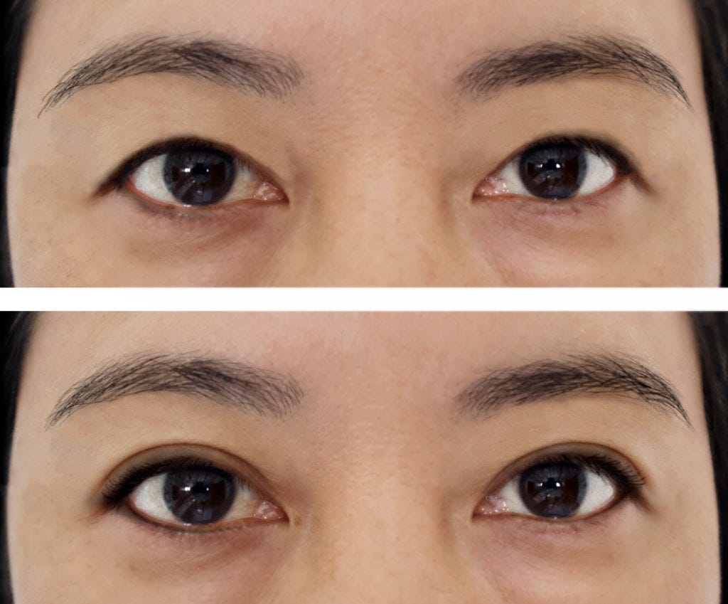 Learn more about Hooded Eyes. What are hooded eyes? | by Clinicafai ...
