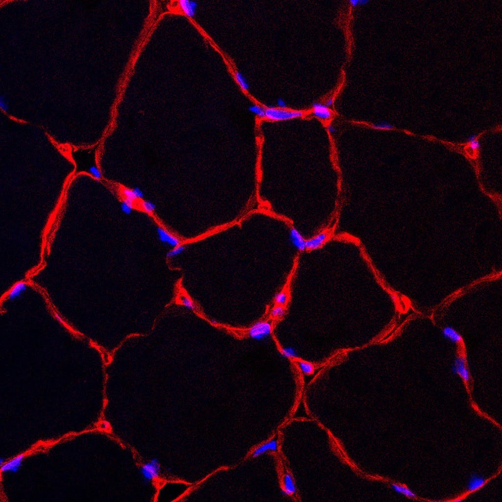 Better muscles | by eLife | Life’s Building Blocks | Medium