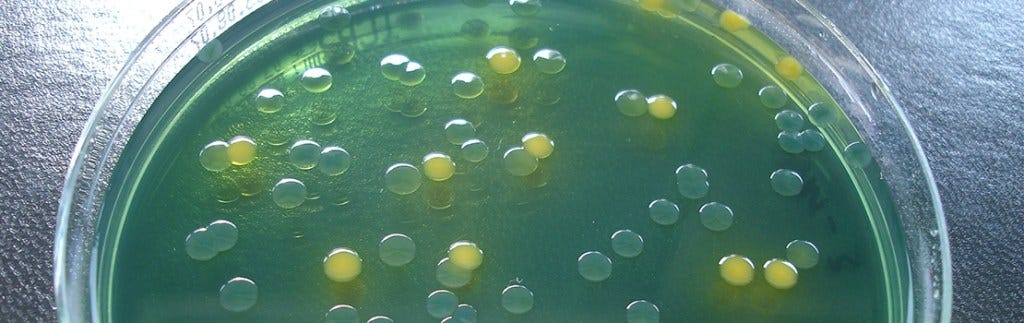 Novel detection methods for dormant bacteria in seafood | by Research ...