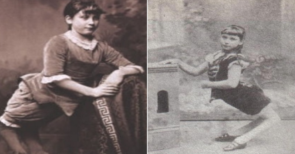 Unveiling the Remarkable Story of Ella Harper: The Camel Girl… Check This Out | by Daphny Joy ...