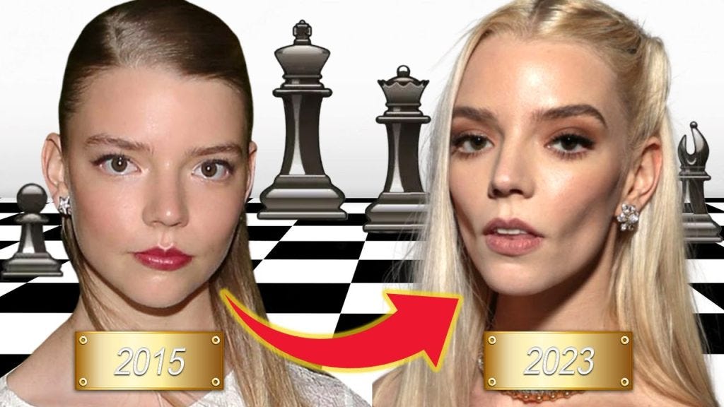Anya Taylor Joy Weight Loss Sculpting Stardom Through Health And Fitness By Jenkinsnbemoody