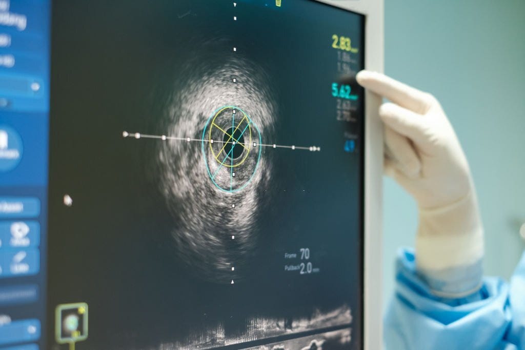 Interpreting Coronary Angiogram Results: What Do the Images Reveal ...