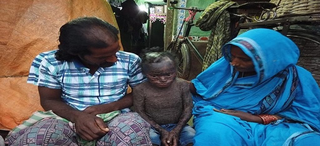 “Jagannath: The Remarkable ‘Human Snake’ of India” Check This Out | by ...