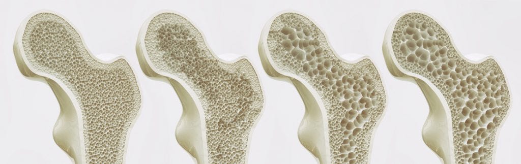 The role of water dynamics in age-related bone weakening | by Research ...