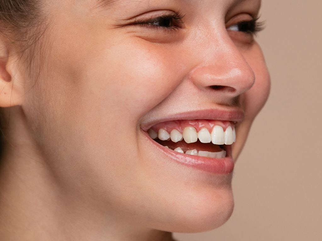 Choosing the Right Shade for Your Hollywood Smile: Tips and ...