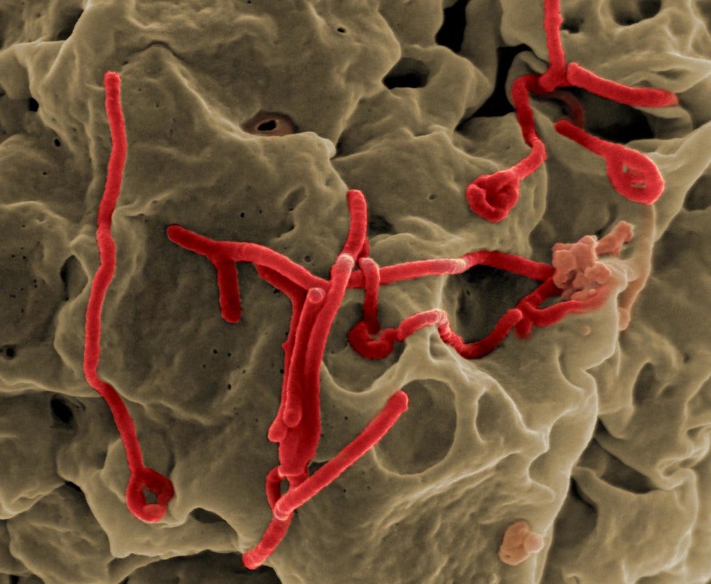 Deadliest Viruses Ever in History | by Emley Amber | Medium