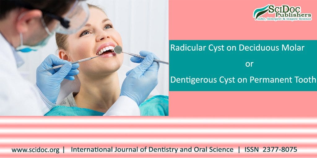 Dental — Research of Radicular Cyst on Permanent Tooth | by SciDoc ...