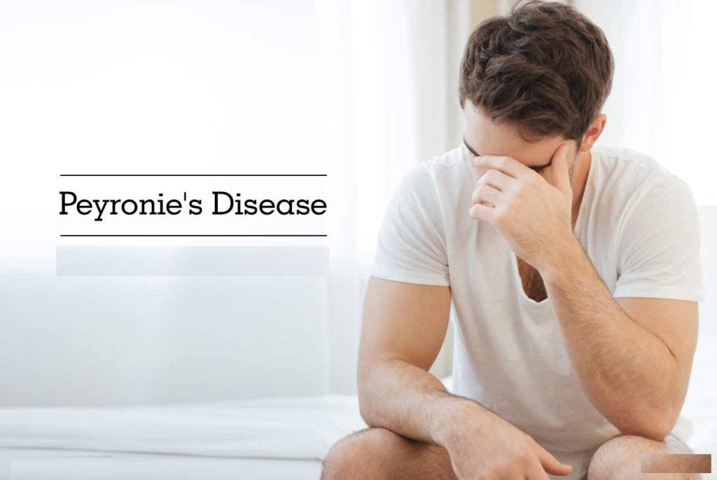 Comprehensive Guide to Peyronie’s Disease Treatment: Find the Best Care ...