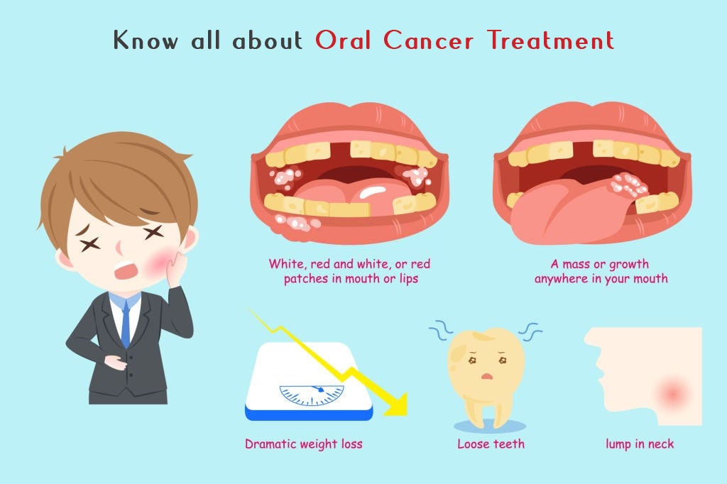 Know all about Oral Cancer Treatment | by Imran Saify | Medium