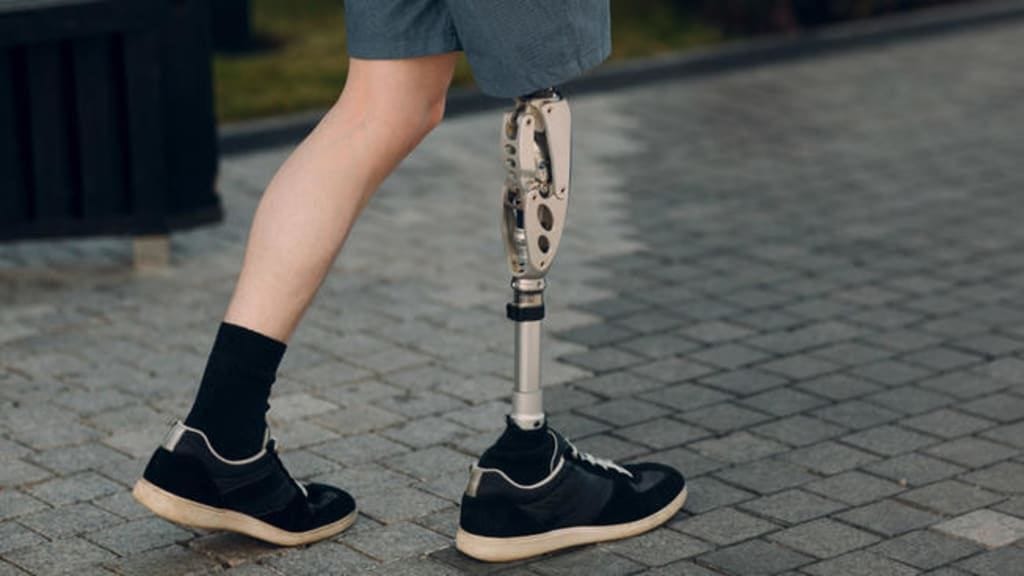 What is prosthetic leg ? only info | Medium
