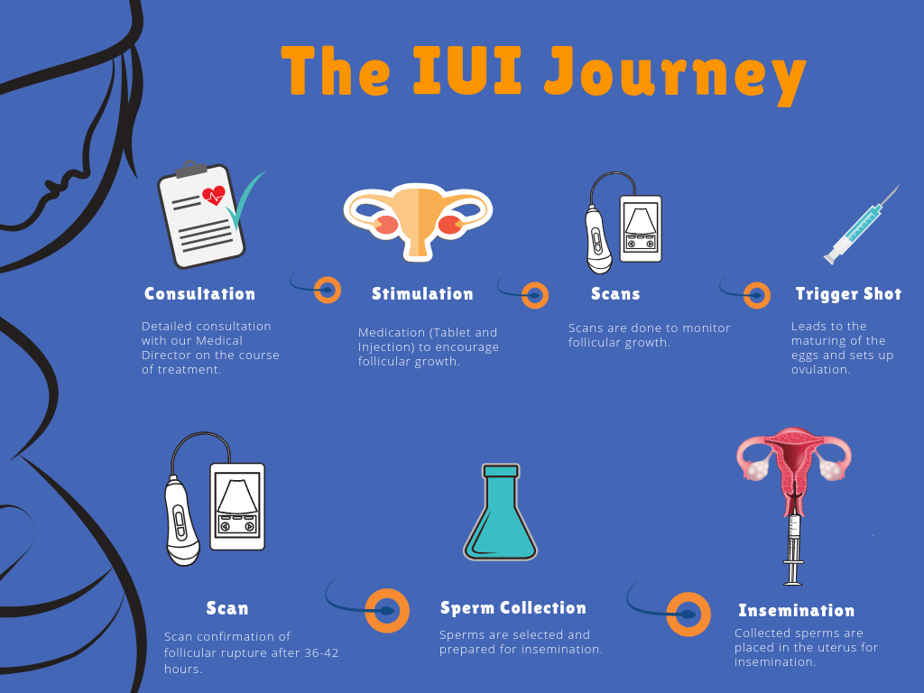 Know In 5 Steps About What Is The Procedure Of IUI? | by Subhag HealthTech | Medium