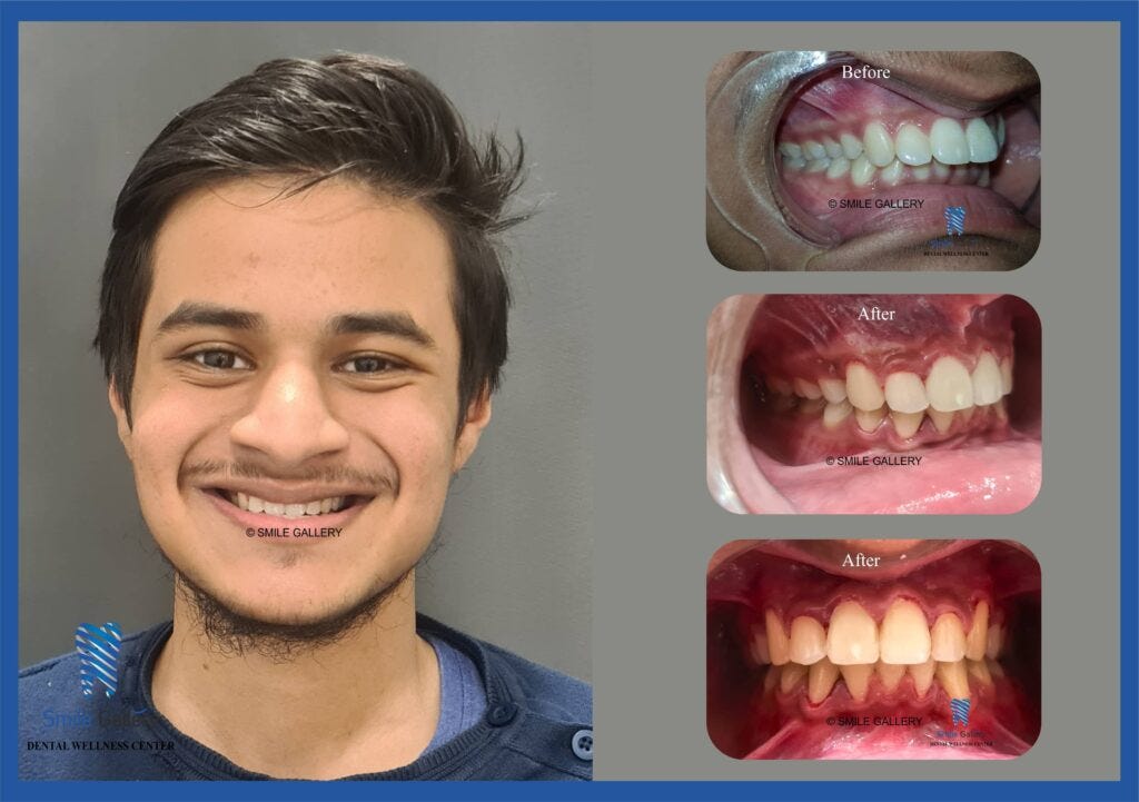 Best Dental Clinic In Bhopal | Smile-gallery.com - Smile Gallery Dental ...