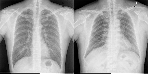 X Ray Examples