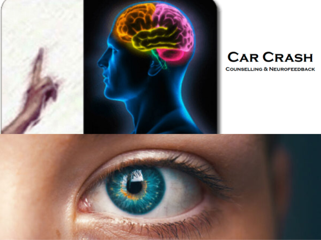 Eye Movement Desensitization And Reprocessing Therapy (EMDR) - ICBC ...