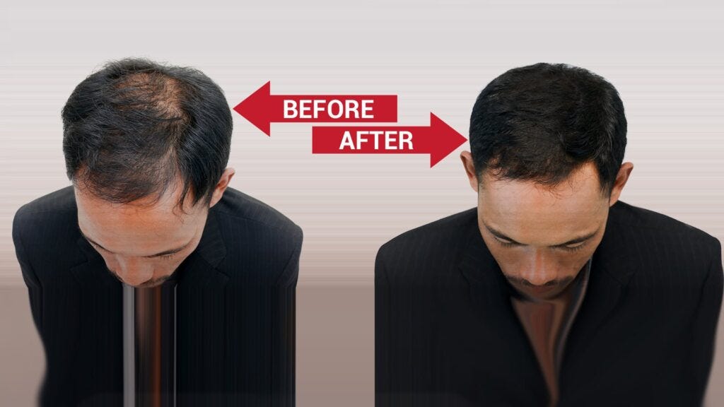 Gorgeous Hair Weaving in Lucknow: Unlocking Seamless Transformation ...