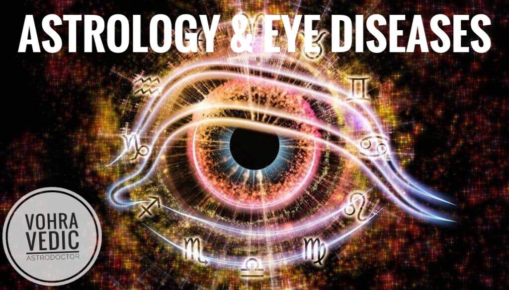 Astrology And Eye Diseases. If you can read this most comprehensive ...