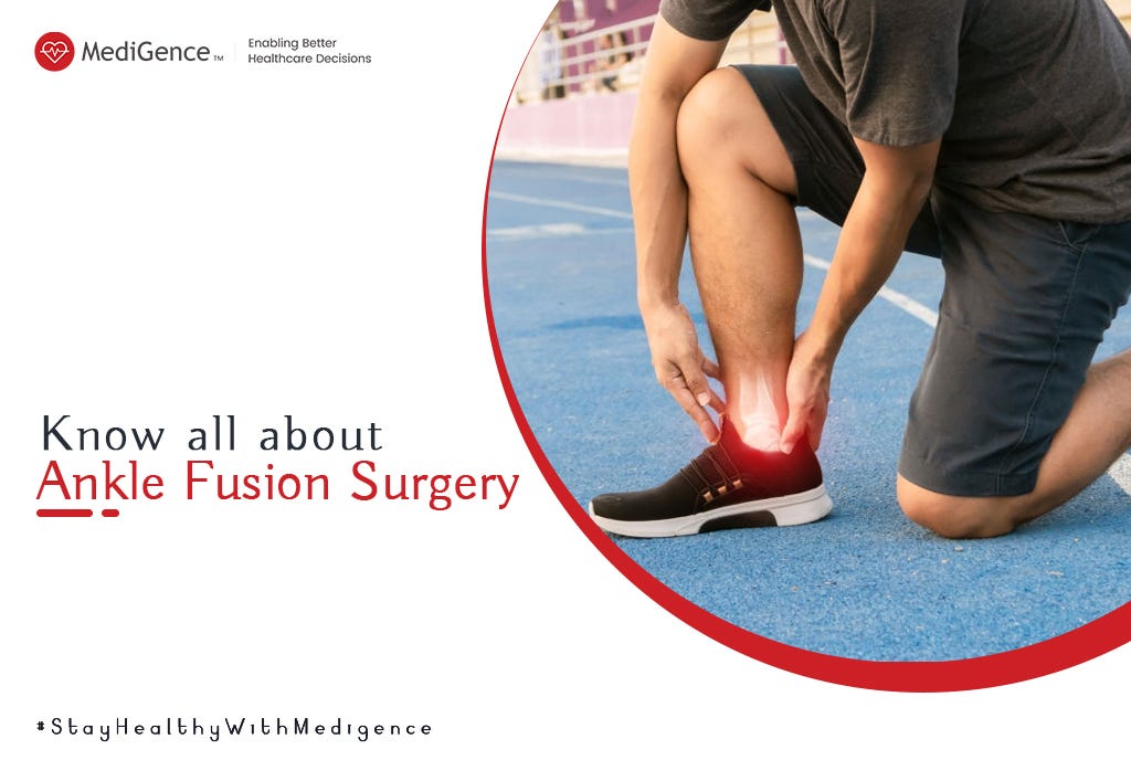 Know all about Ankle Fusion Surgery | by Imran Saify | Medium