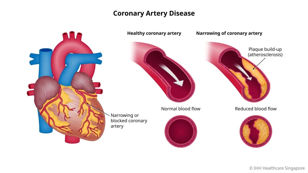 Resuscitating a Dying Heart: Using Stem Cells to Prevent & Cure ...