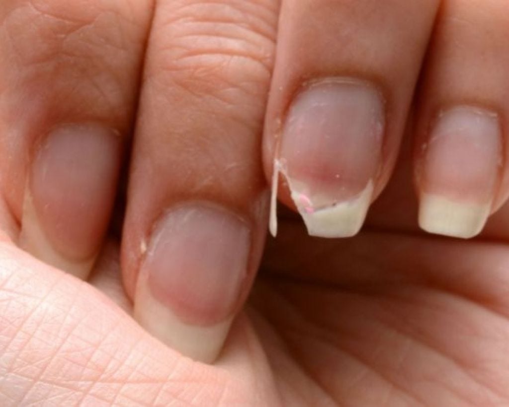 5 tips to improve weak nails. The nails are composed of keratin, the ...