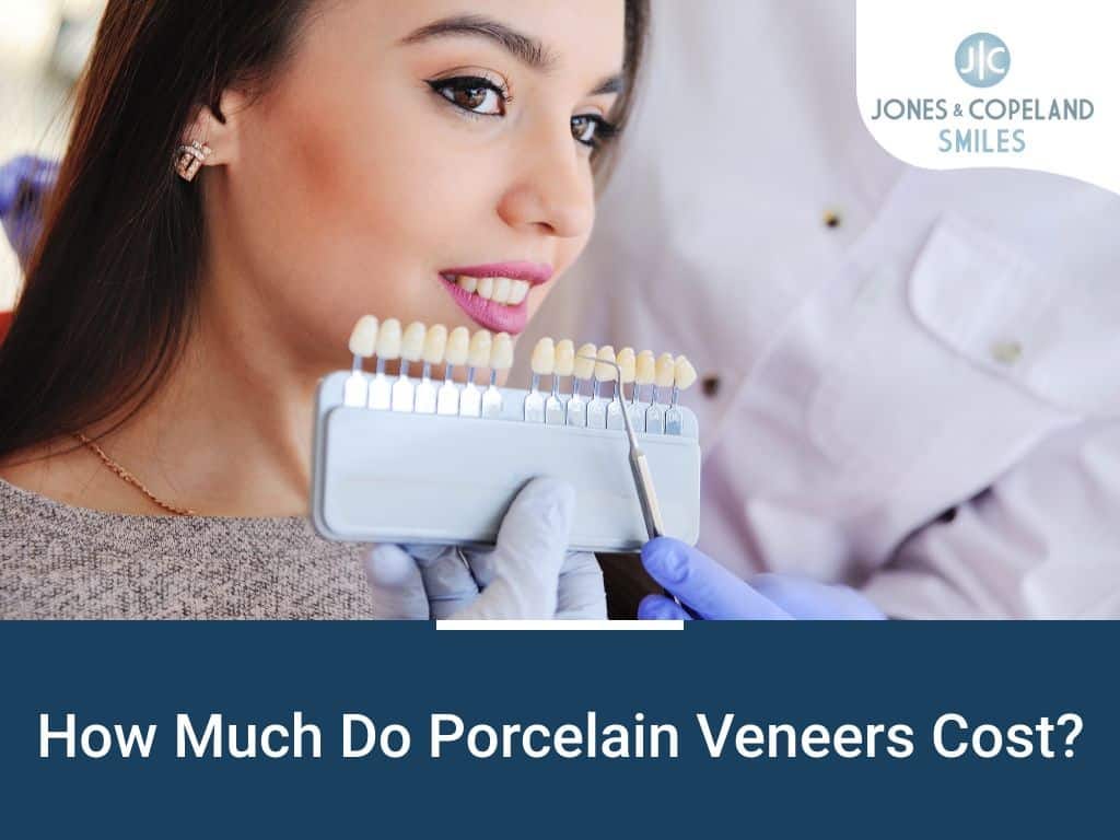 How Much Do Porcelain Veneers Cost? | by Jones & Copeland Smiles | Medium