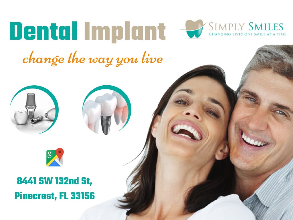 Complete Implant Procedure at Simply Smiles Miami | by Simply Smiles ...