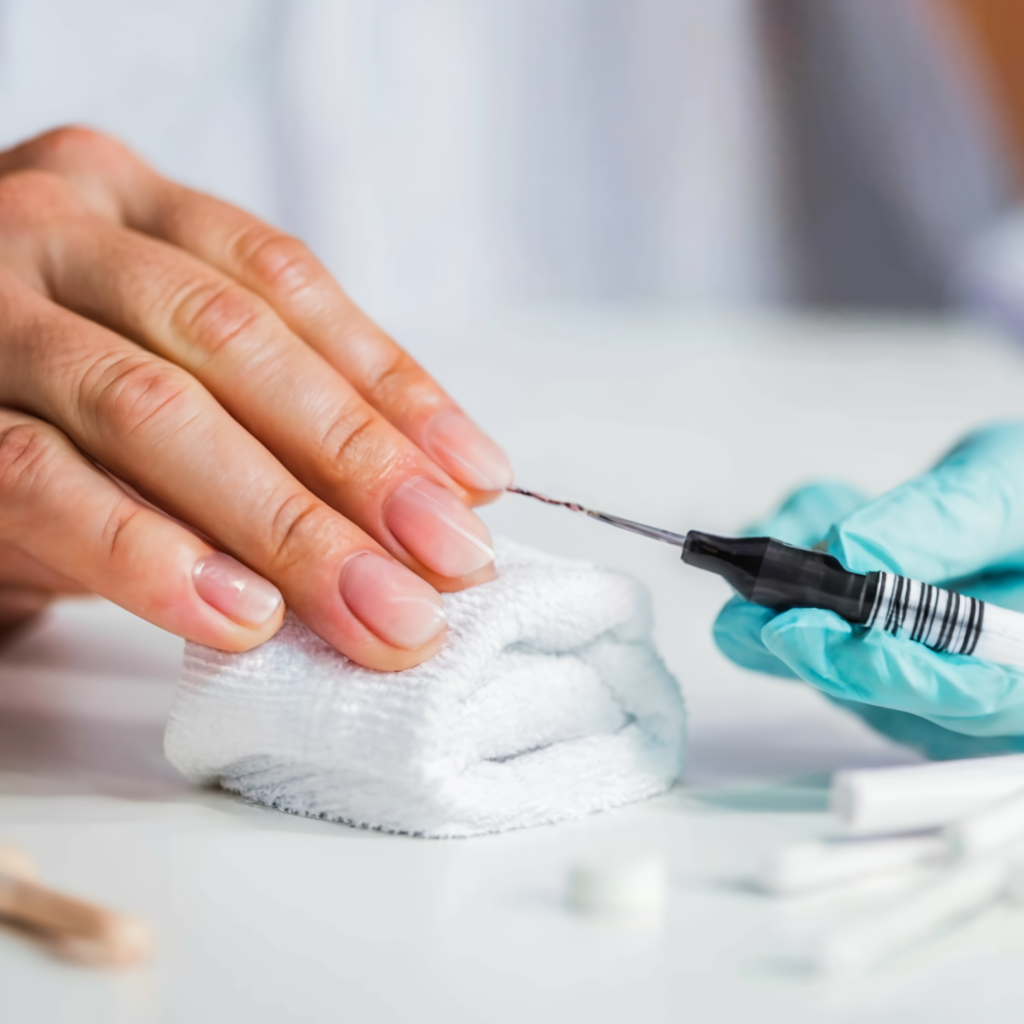 A Comprehensive Review of Nail Infection Treatments: From Over-the ...