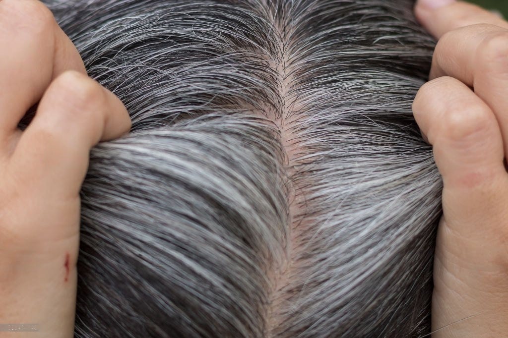 White hairs at a younger age. White hairs at a younger age | by Hashim ...