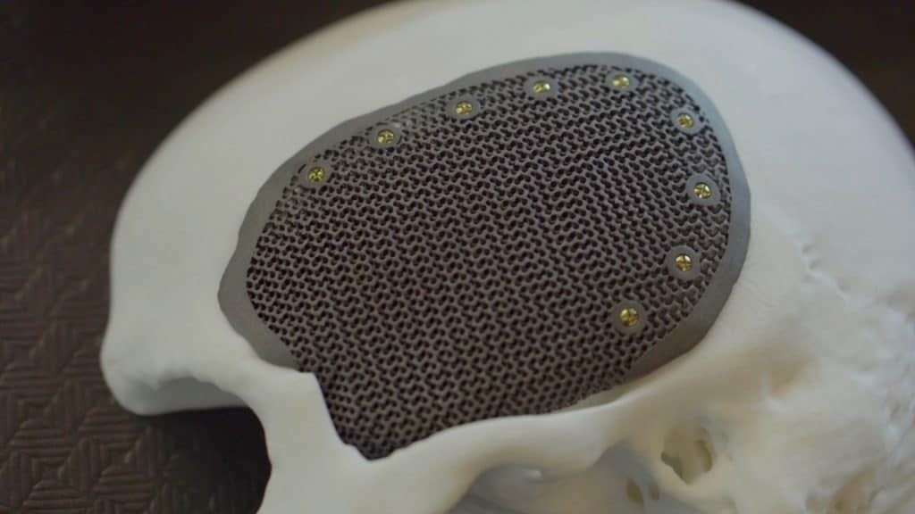 Interview: Greg Cebular, The Technology House (TTH), Ohio | by 3DHEALS ...