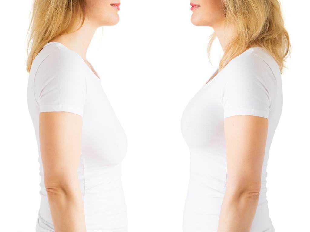 Breast Augmentation–Types of Breast Implants | by Dr. Anna Female ...