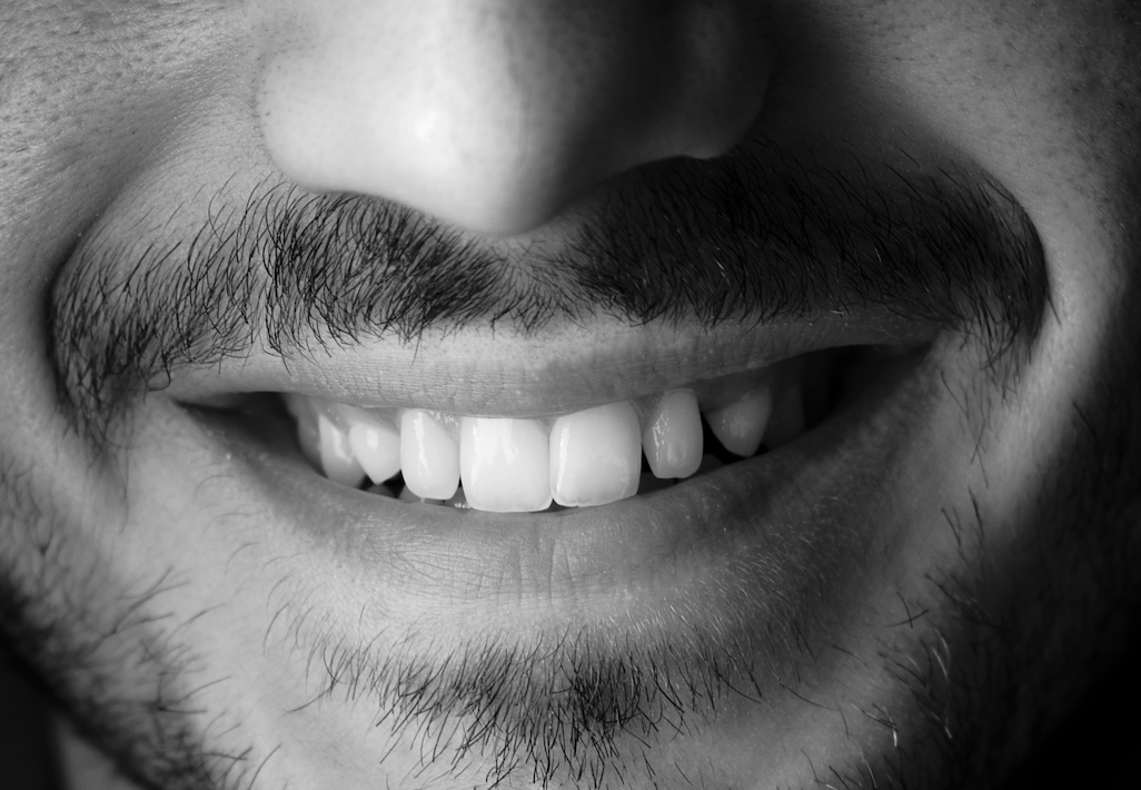Glistening White Teeth: How Do People Actually Get Them? | by Ikraan ...