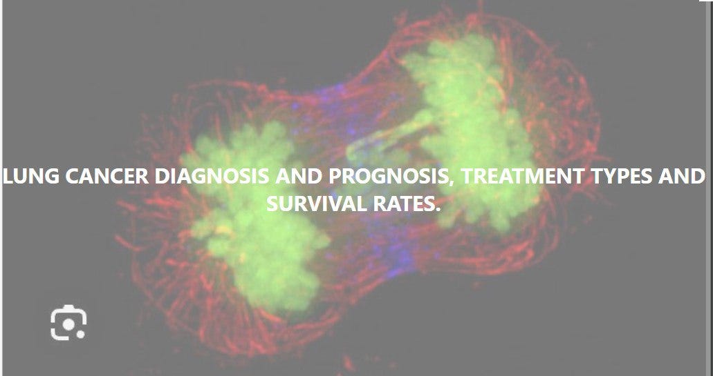 Data Analysis Project #2. Lung Cancer Diagnosis Analysis | by ...