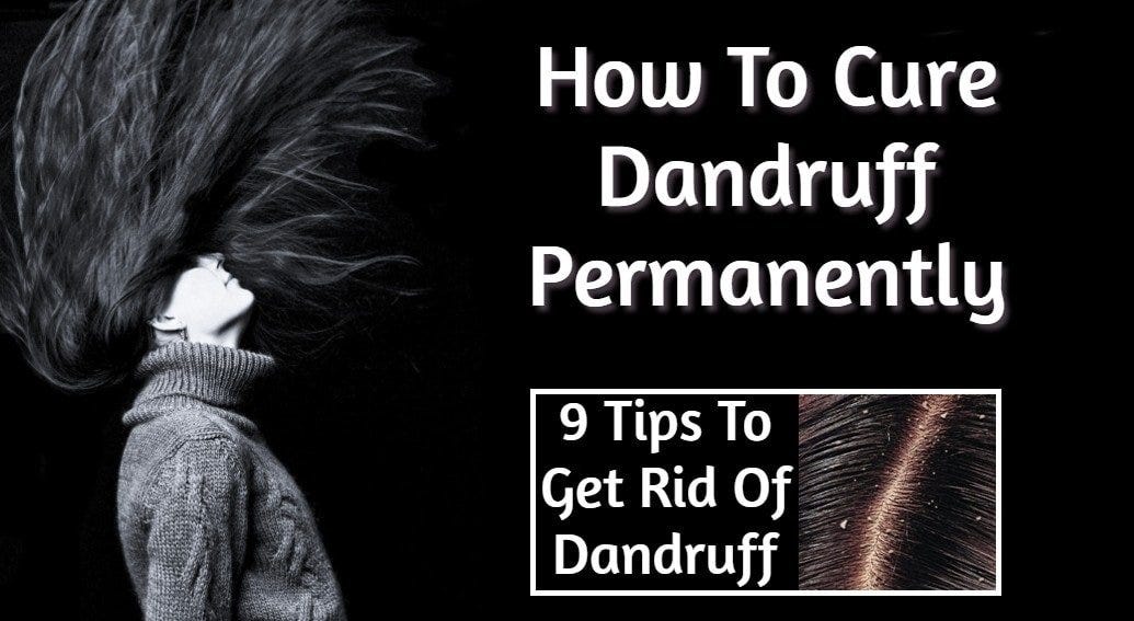 How To Cure Dandruff Permanently 9 Tips to Get Rid of Dandruff | by ...