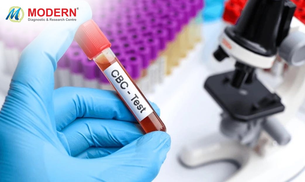 CBC (Complete Blood Count) test in Varanasi | Modern Diagnostic ...