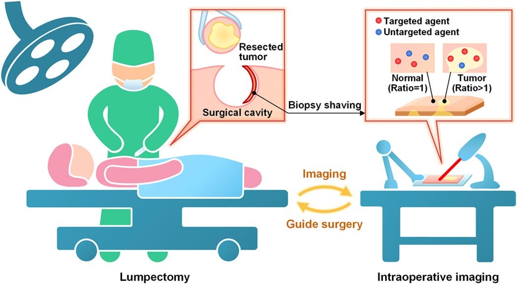 Global Lumpectomy Market’s Growth Story: Developing Nations in the ...