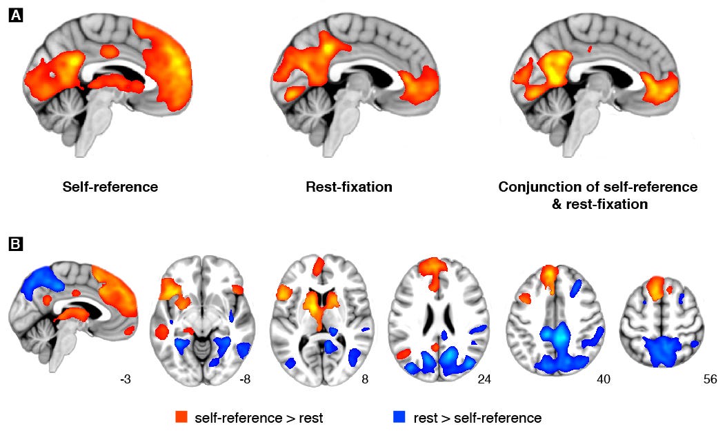 Finding the self in the brain | by Christopher Davey | The Intensities ...