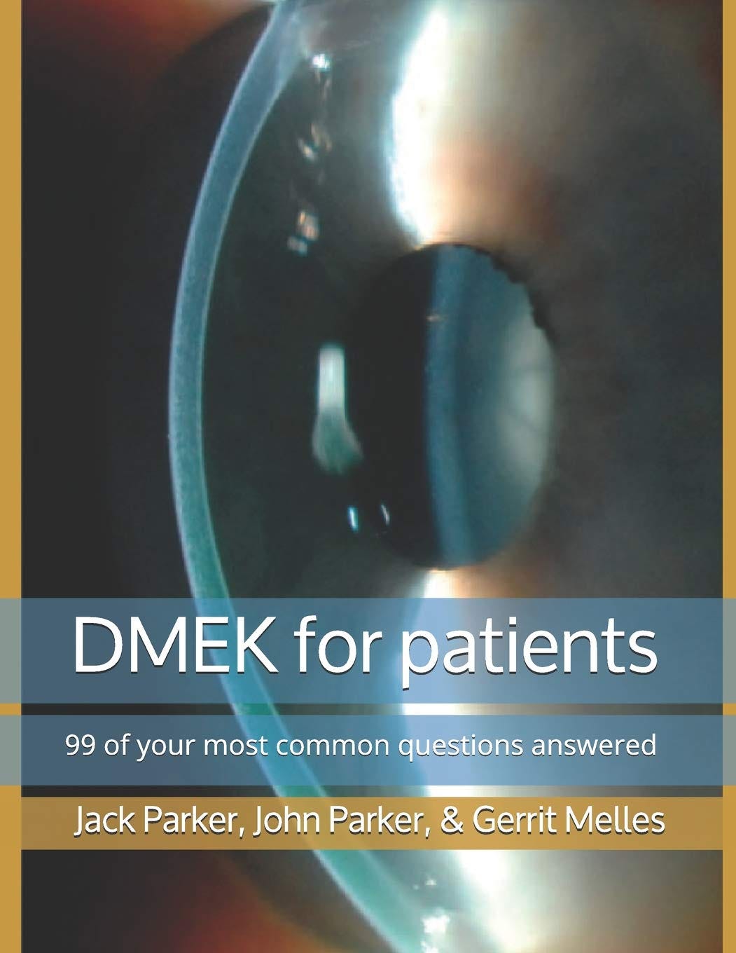 [DOWNLOAD]-DMEK for patients: 99 of your most common questions answered ...