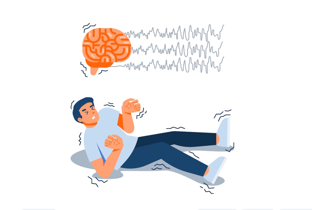 Seizures In Adults