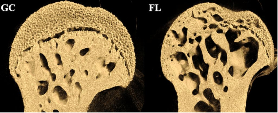 Bones Beyond Earth: Understanding Bone Density Loss in Space | by Queen ...
