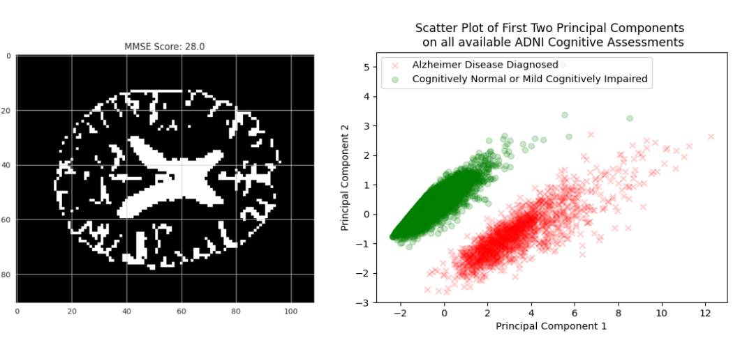 Neuroimaging for Cognitive Assessment Prediction | by Patrick Jose ...