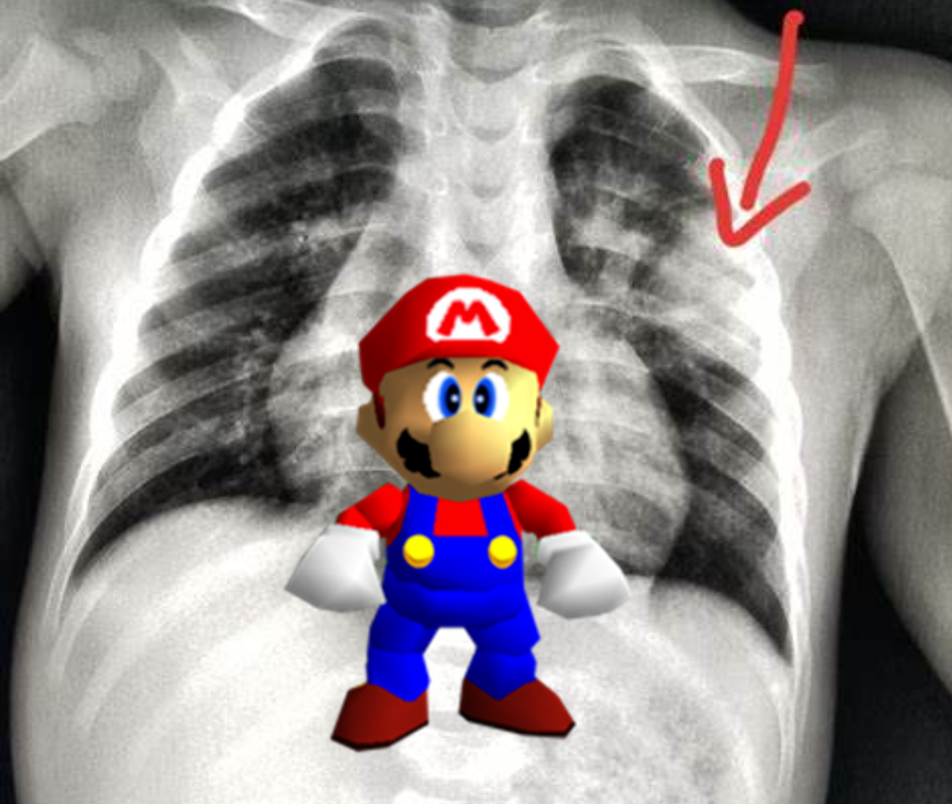How Pneumonia Made Me a Gamer. Super Mario 64. This was the game that ...