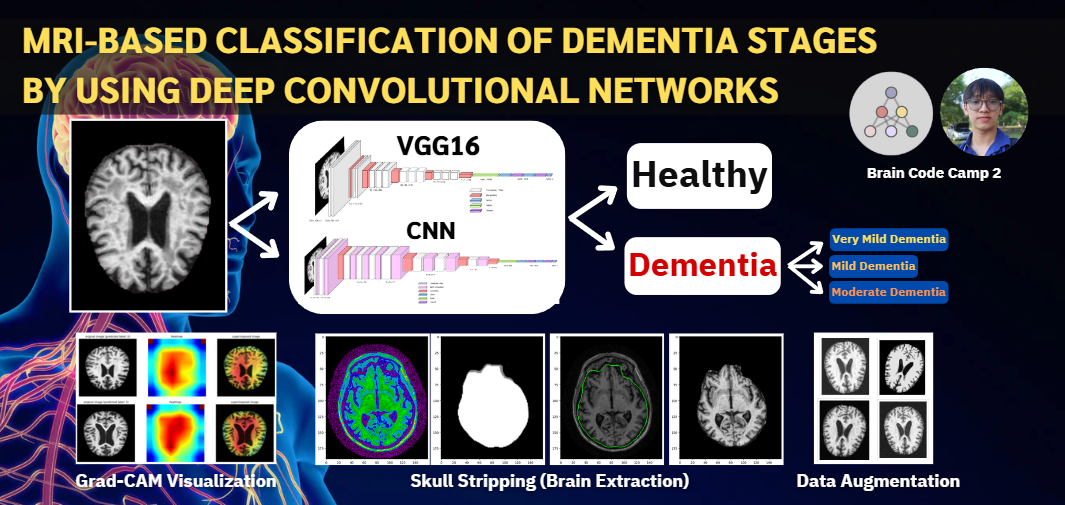 MRI-Based Classification of DEMENTIA STAGES by Using Deep Convolutional Networks | by Matthew ...
