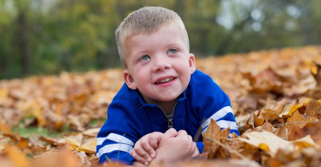 Noonan Syndrome. Noonan Syndrome is a genetic disorder… | by Susan C ...