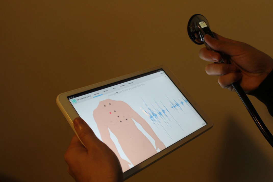 Brief Review — The CirCor DigiScope Dataset: From Murmur Detection to ...