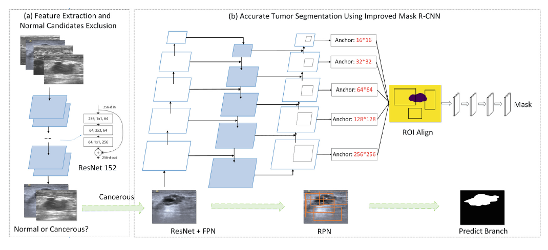 Brief Review — Breast Ultrasound Image Classification And Segmentation Using Convolutional