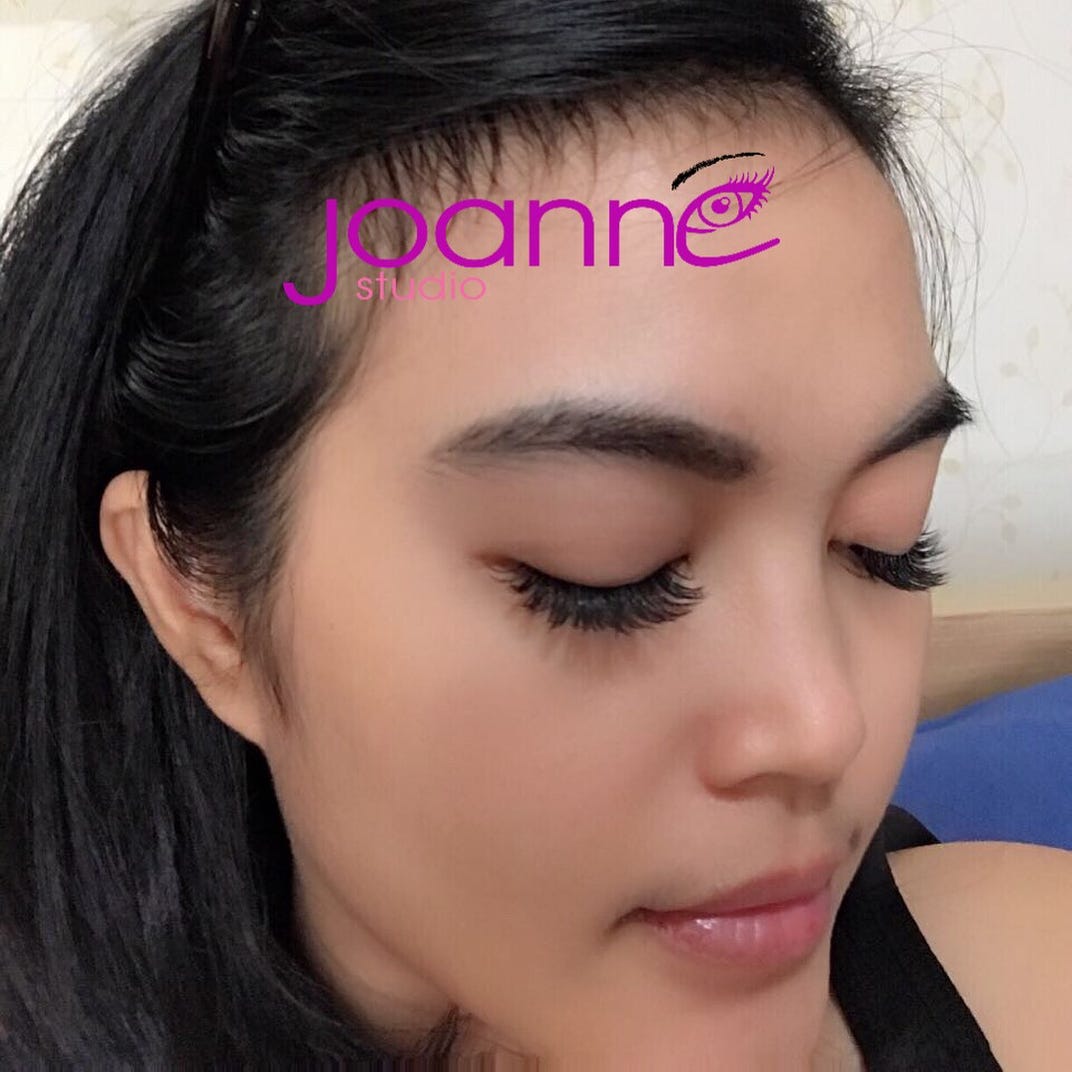 Blepharitis, Penyakit Yang Membuat Seseorang Tidak Bisa Melakukan ...