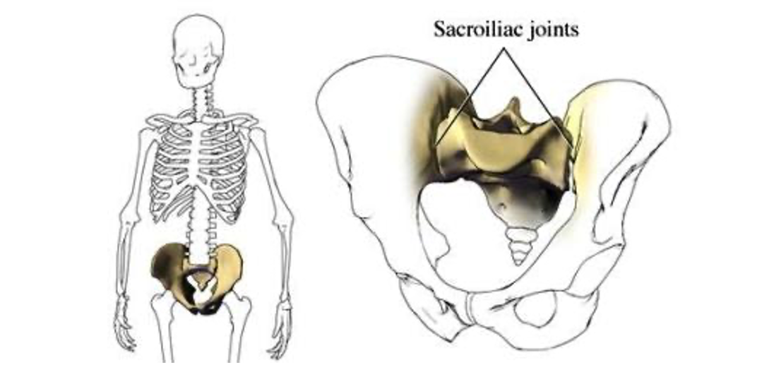 Working with Sacroiliac Joint Dysfunction | by Yoga Australia | Yoga ...